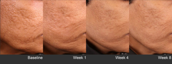 BIOJUVE | Rethink how you care for your skin